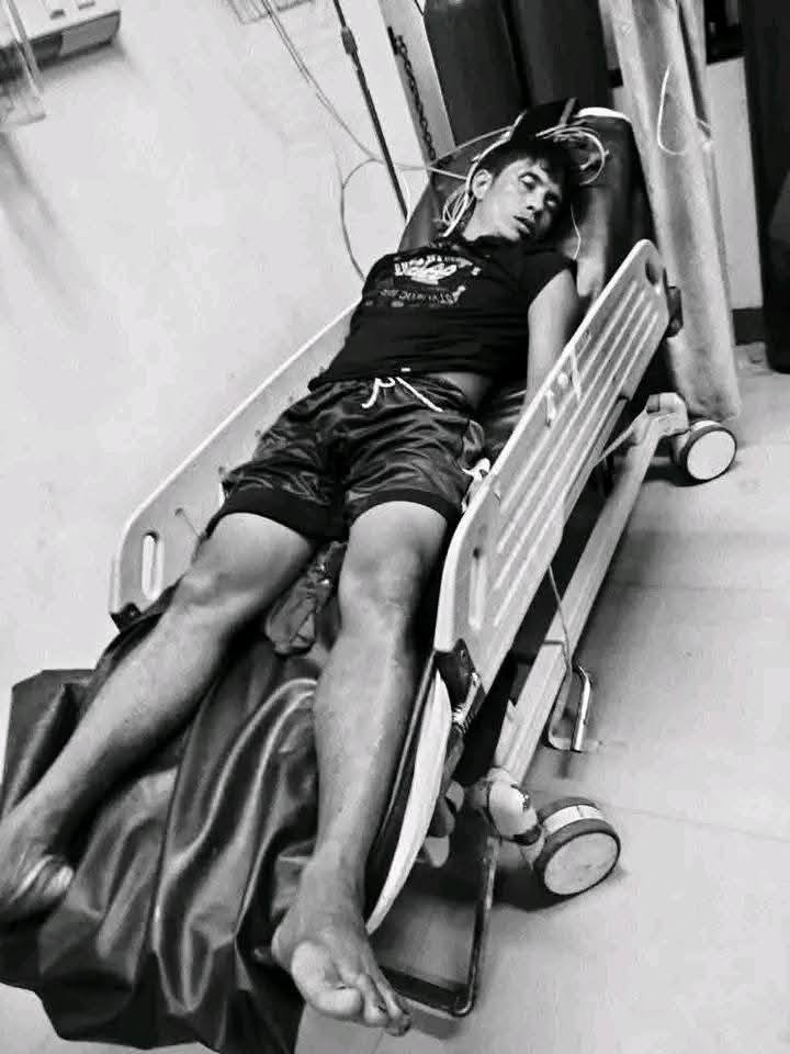 Young Man Dies After Snake Bite in San Miguel, Zamboanga del Sur ...