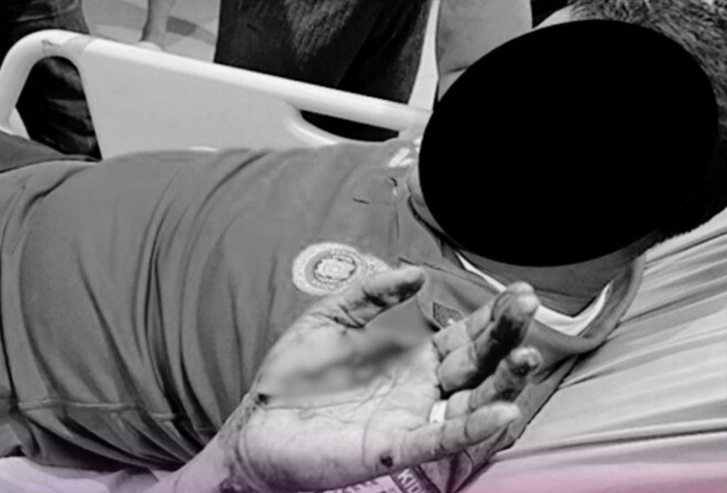 Drunk Man Killed After Attacking Responding Police Officer in Bukidnon ...